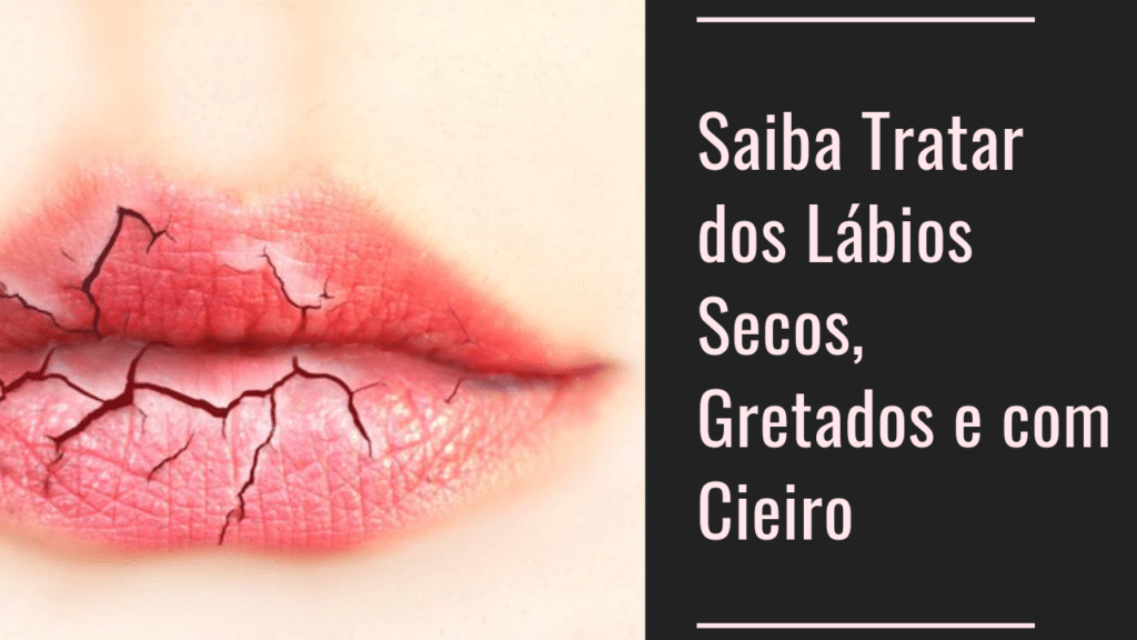 Saiba Tratar dos Lábios Secos, Gretados e com Cieiro